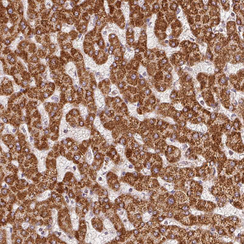 Mouse Monoclonal Anti-SDHB Antibody - Buy for research - Highly ...