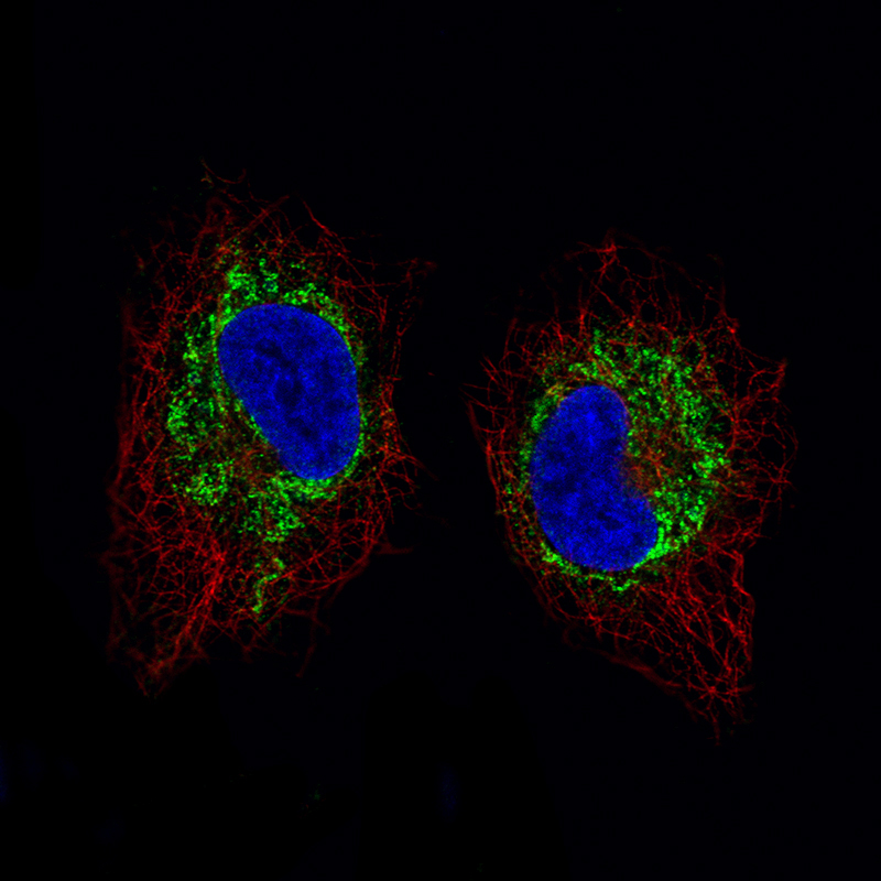Mouse Monoclonal Anti-SDHB Antibody - Buy for research - Highly specific, rigorously validated ...