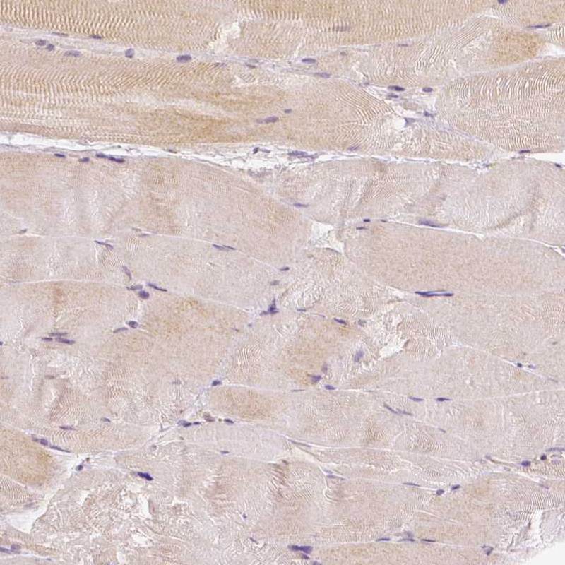 Mouse Monoclonal Anti-RHOT1 Antibody - Buy for research - Highly ...
