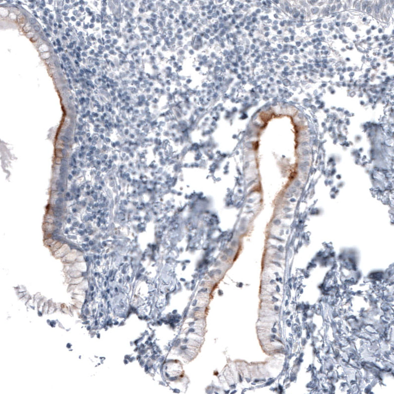 Anti-MUC16 Monoclonal Atlas Antibody