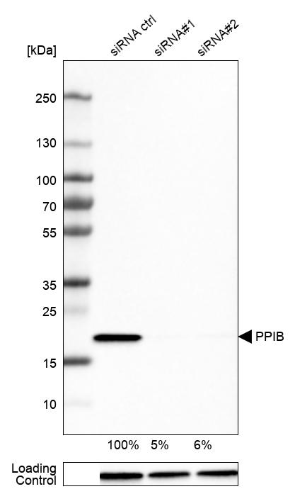 Mouse Monoclonal Anti-PPIB Antibody - Buy for research - Highly specific, rigorously validated ...