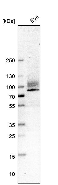 Mouse Monoclonal Anti-ITGB8 Antibody - Buy for research - Highly specific, rigorously validated ...