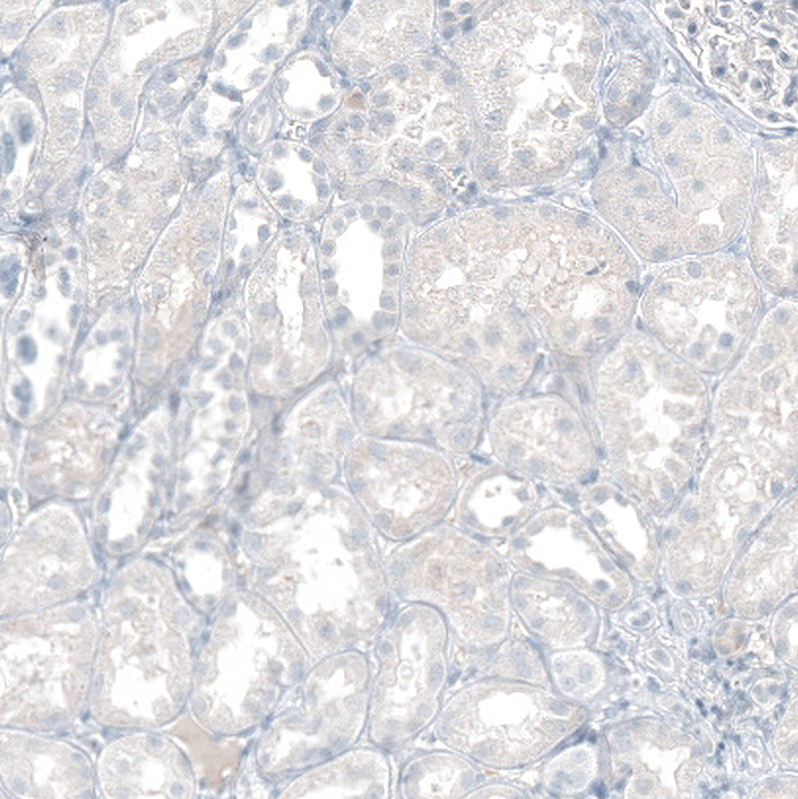 Anti-CXCL13 Monoclonal Atlas Antibody