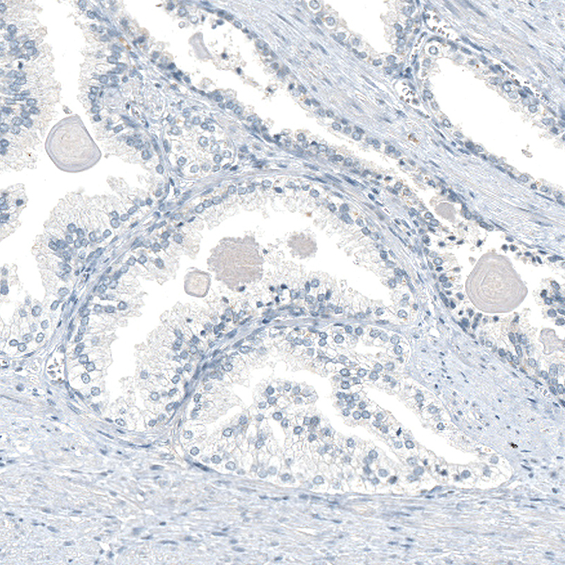 Mouse Monoclonal Anti-AGER Antibody - Buy for research - Highly specific, rigorously validated ...