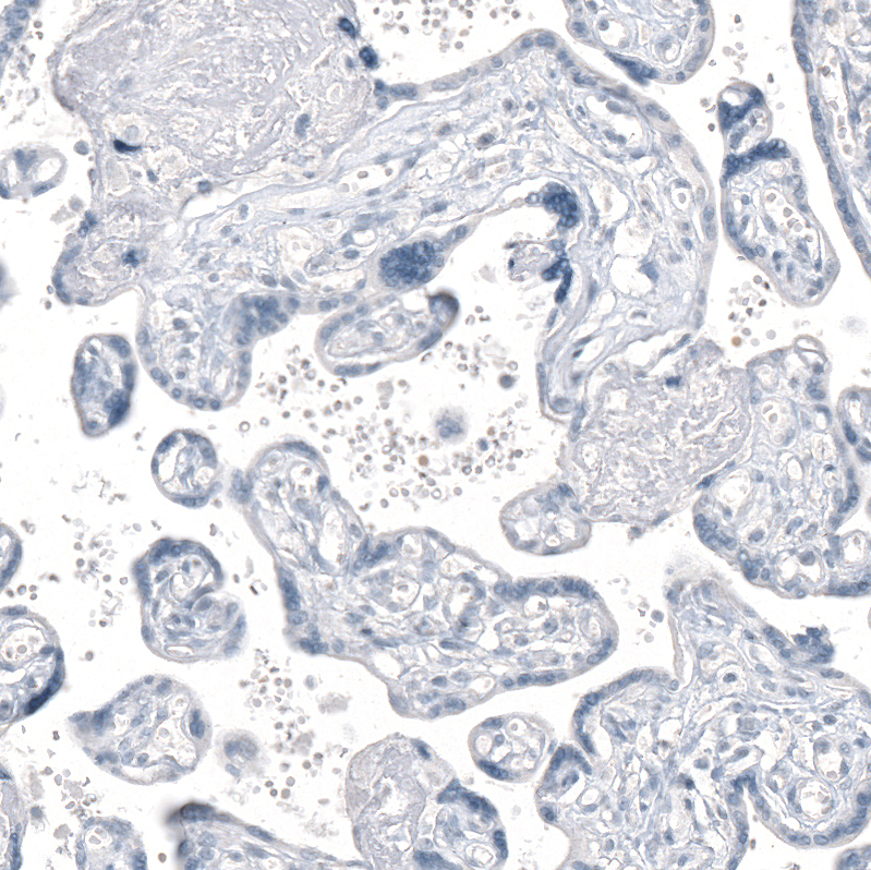Mouse Monoclonal Anti-AGER Antibody - Buy for research - Highly specific, rigorously validated ...