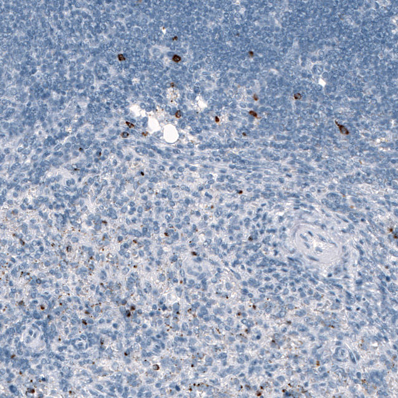 Mouse Monoclonal Anti-GZMB Antibody - Buy for research - Highly ...