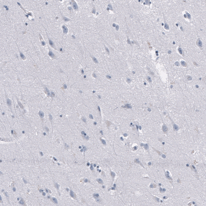 Mouse Monoclonal Anti-GZMB Antibody - Buy for research - Highly ...