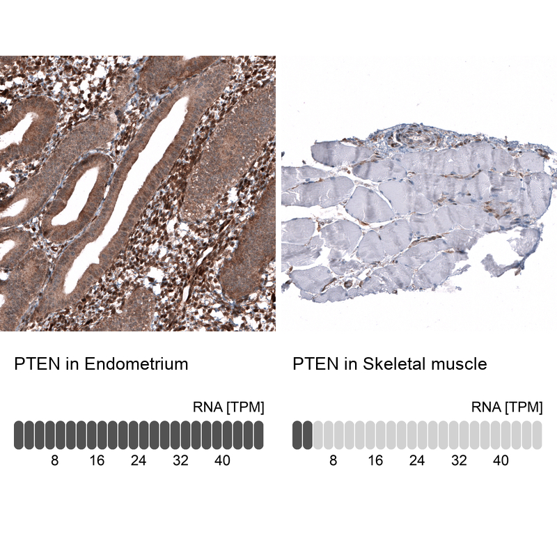 Mouse Monoclonal Anti-PTEN Antibody - Buy for research - Highly ...