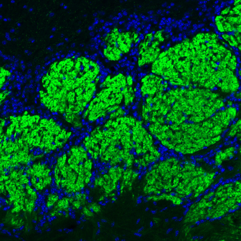 Anti-VGLUT2 Monoclonal Atlas Antibody