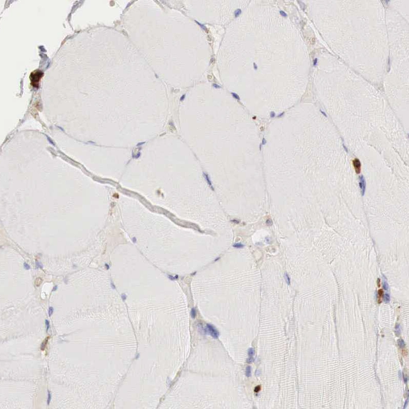 Anti-G6PD Human Protein Atlas Antibody