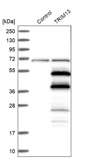 Anti-TRIM13 Human Protein Atlas Antibody