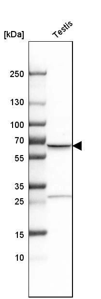 Anti-TKTL1 Human Protein Atlas Antibody