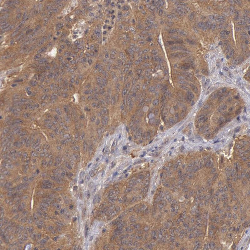 Anti-BRAF Human Protein Atlas Antibody