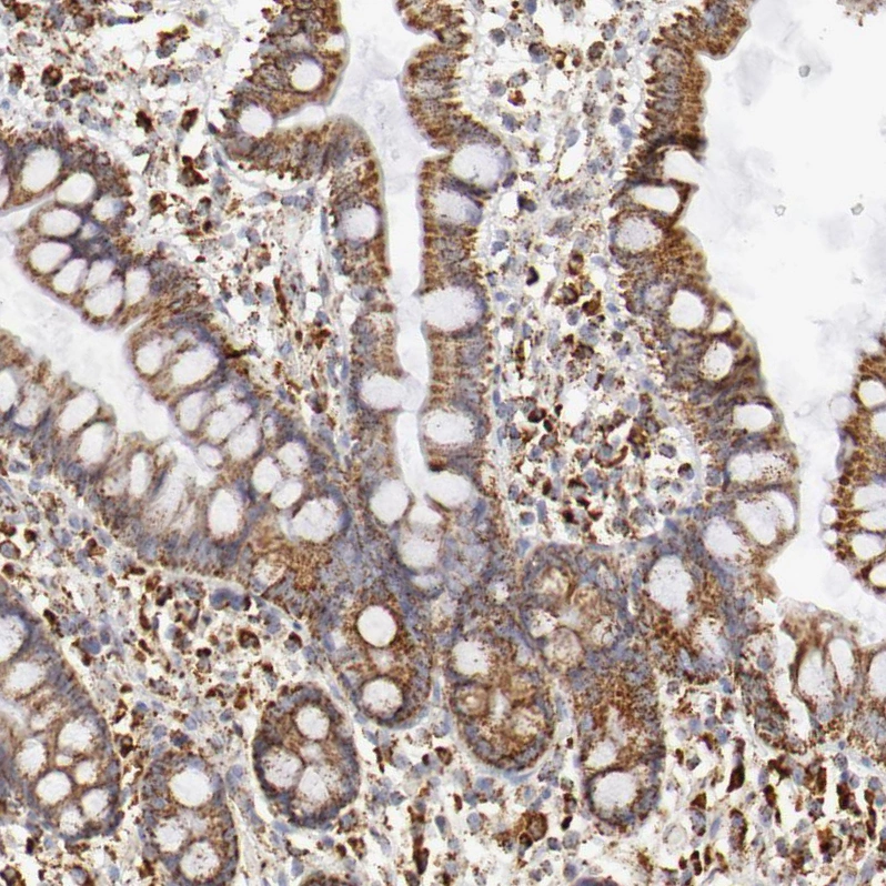 Anti-ATP5B Human Protein Atlas Antibody