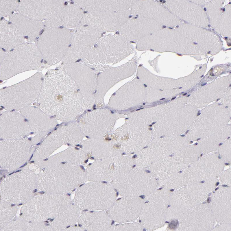 Rabbit Polyclonal Anti-ZFX Antibody - Buy for research - Highly ...