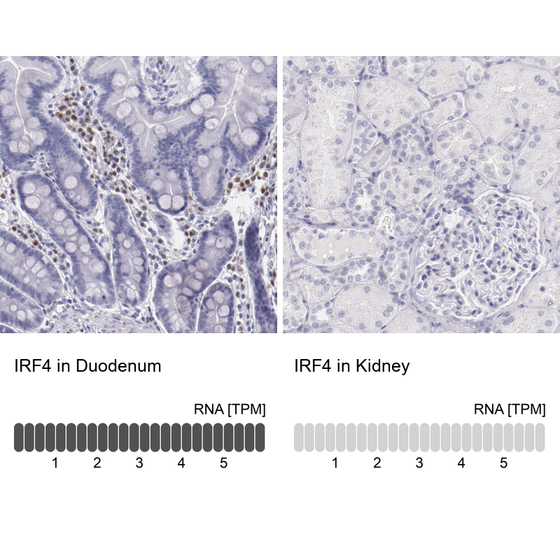 Anti-IRF4 Human Protein Atlas Antibody