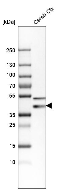 Anti-SYP Human Protein Atlas Antibody