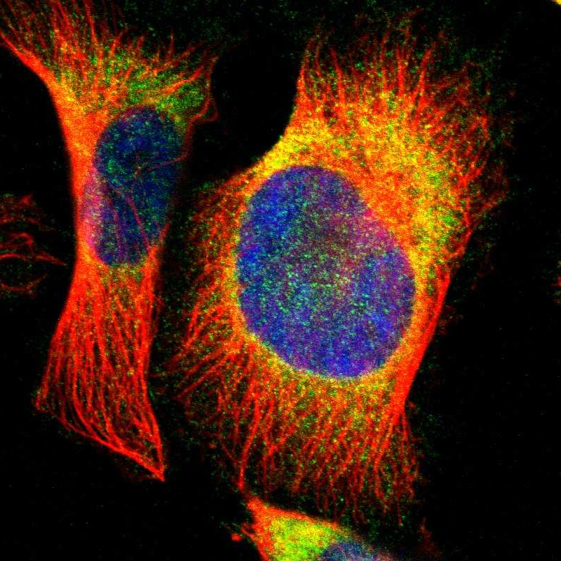 Anti-EBP Human Protein Atlas Antibody