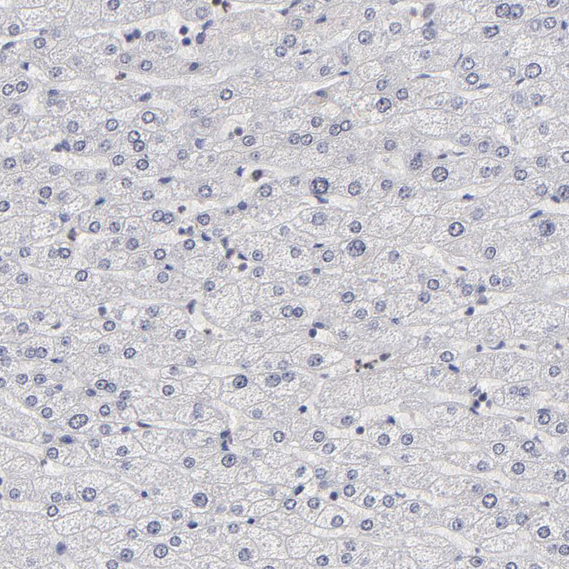 Rabbit Polyclonal Anti-ZNF773 Antibody - Buy for research - Highly ...