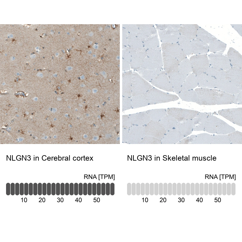 Rabbit Polyclonal Anti-NLGN3 Antibody - Buy for research - Highly ...