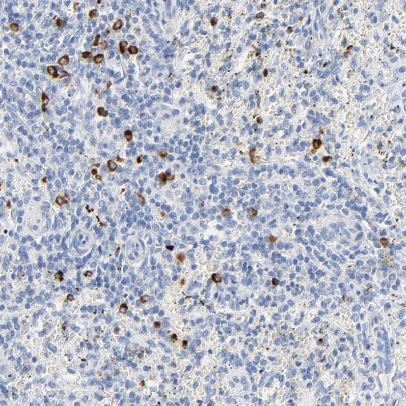 Anti-GZMB Human Protein Atlas Antibody