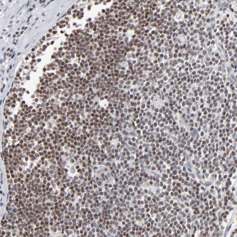 Anti-MAX Human Protein Atlas Antibody