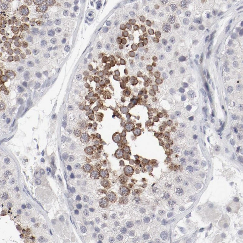Anti-FSCB Human Protein Atlas Antibody