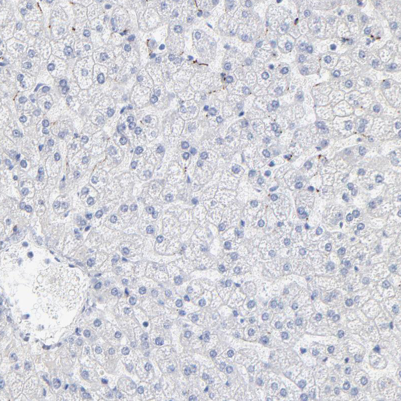 Anti-CPE Human Protein Atlas Antibody