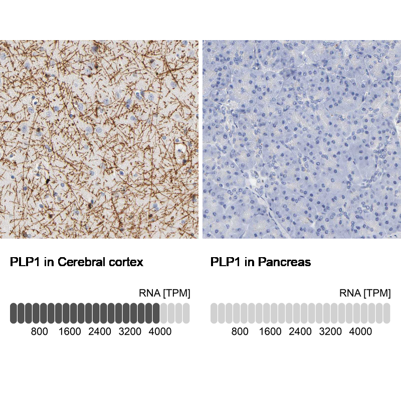 Anti-PLP1 Human Protein Atlas Antibody