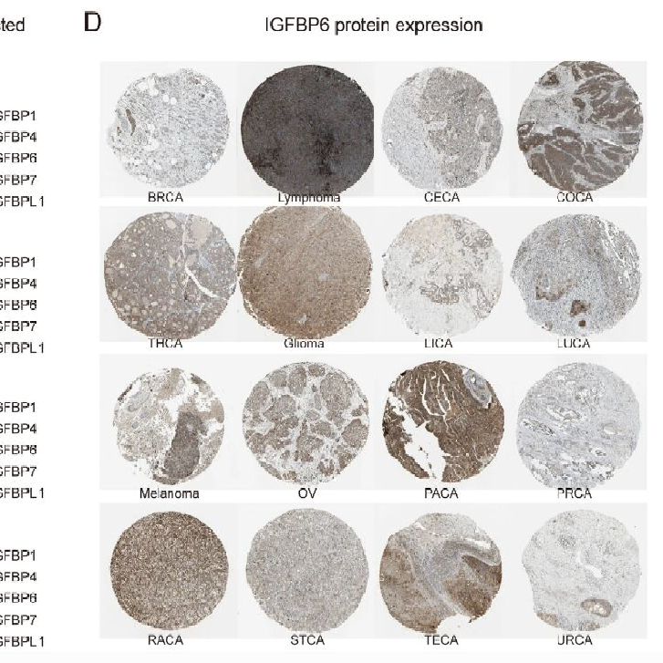 Anti-IGFBP6 polyclonal in various cancer types researches