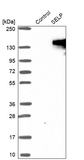 Rabbit Polyclonal Anti-SELP Antibody - Buy for research - Highly ...