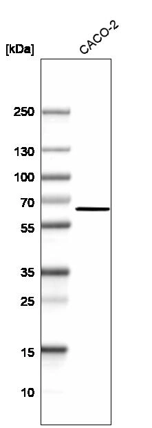 Anti-ME1 Human Protein Atlas Antibody