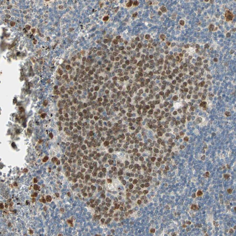 Rabbit Polyclonal Anti-RAD18 Antibody - Buy for research - Highly specific, rigorously validated ...