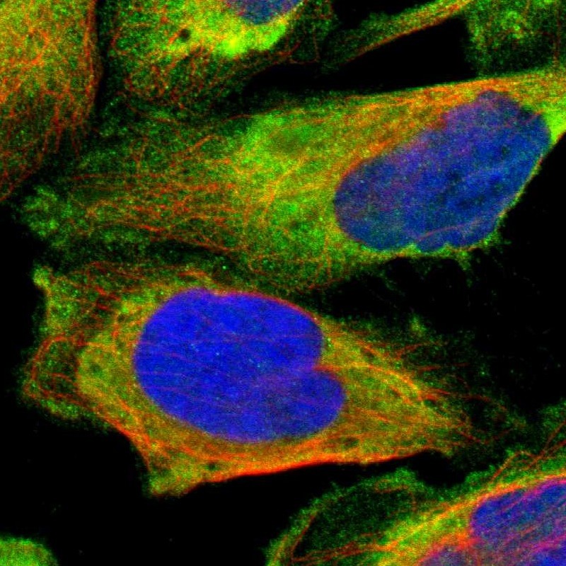 Rabbit Polyclonal Anti-LRRFIP1 Antibody - Buy for research - Highly ...