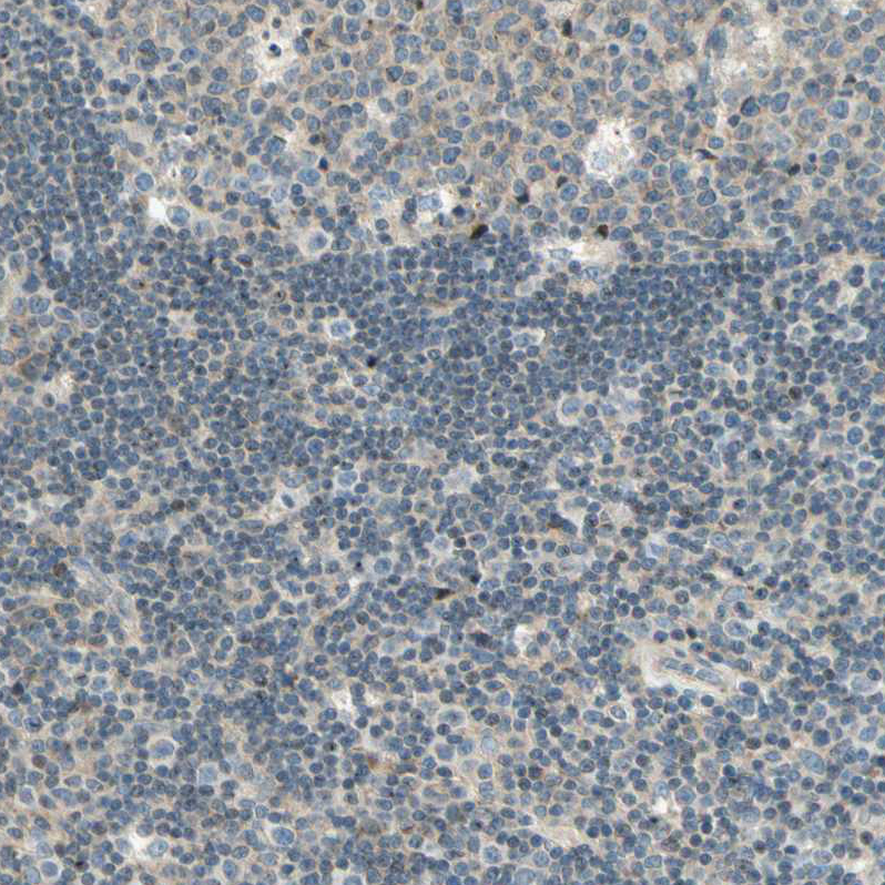 Anti-CDH6 Human Protein Atlas Antibody