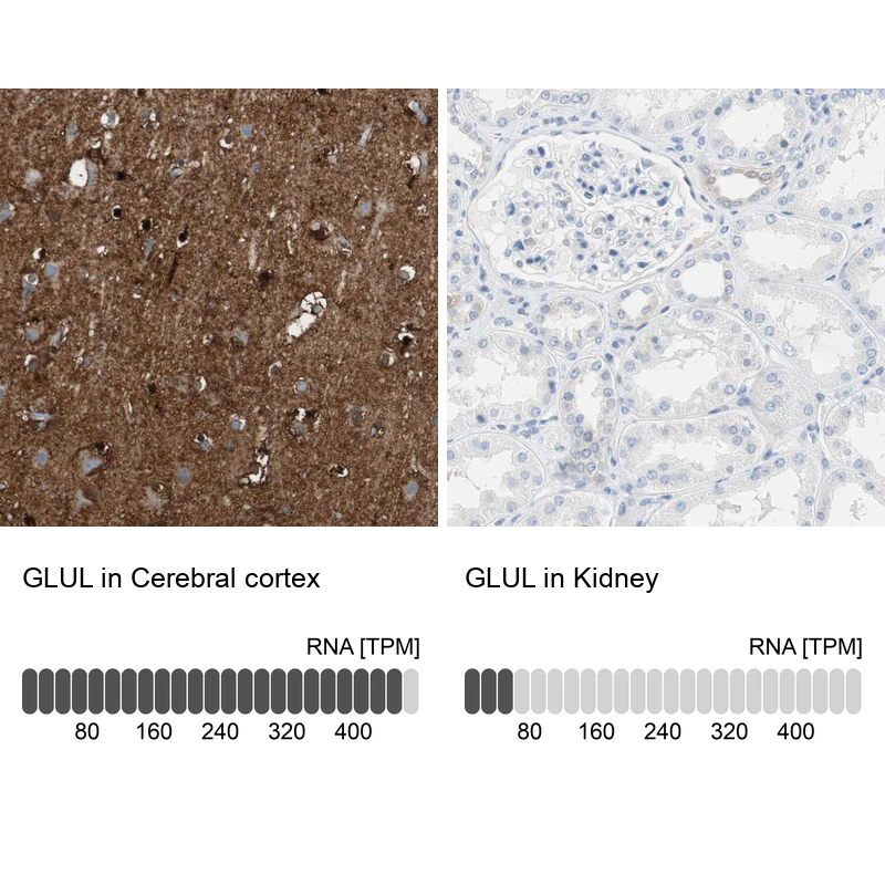 Anti-GLUL Human Protein Atlas Antibody