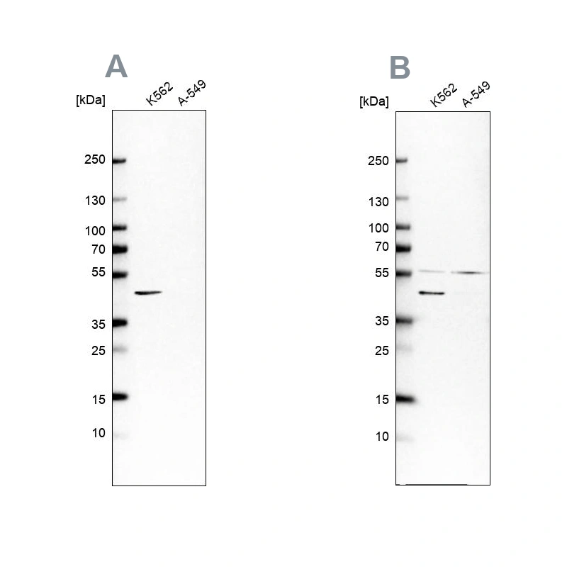 Anti-GLUL Human Protein Atlas Antibody