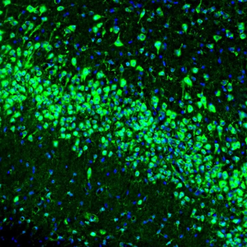 Rabbit Polyclonal Anti-LRPAP1 Antibody - Buy for research - Highly ...