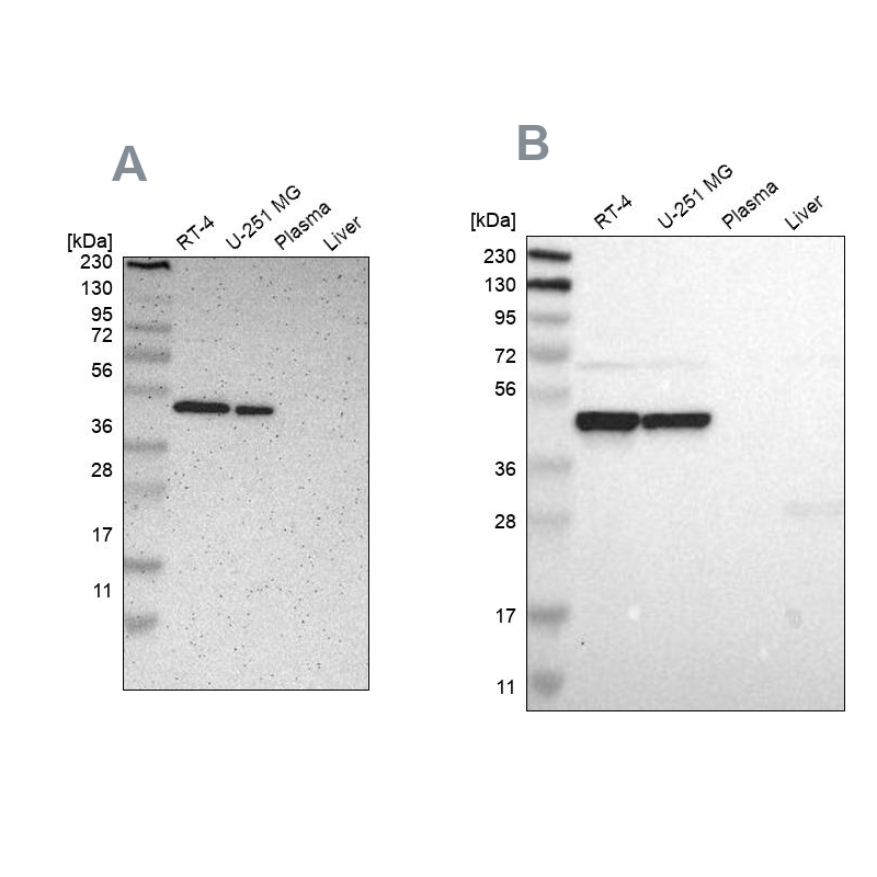 Rabbit Polyclonal Anti-FAM98B Antibody - Buy for research - Highly ...