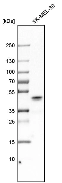 Anti-QPCT Human Protein Atlas Antibody