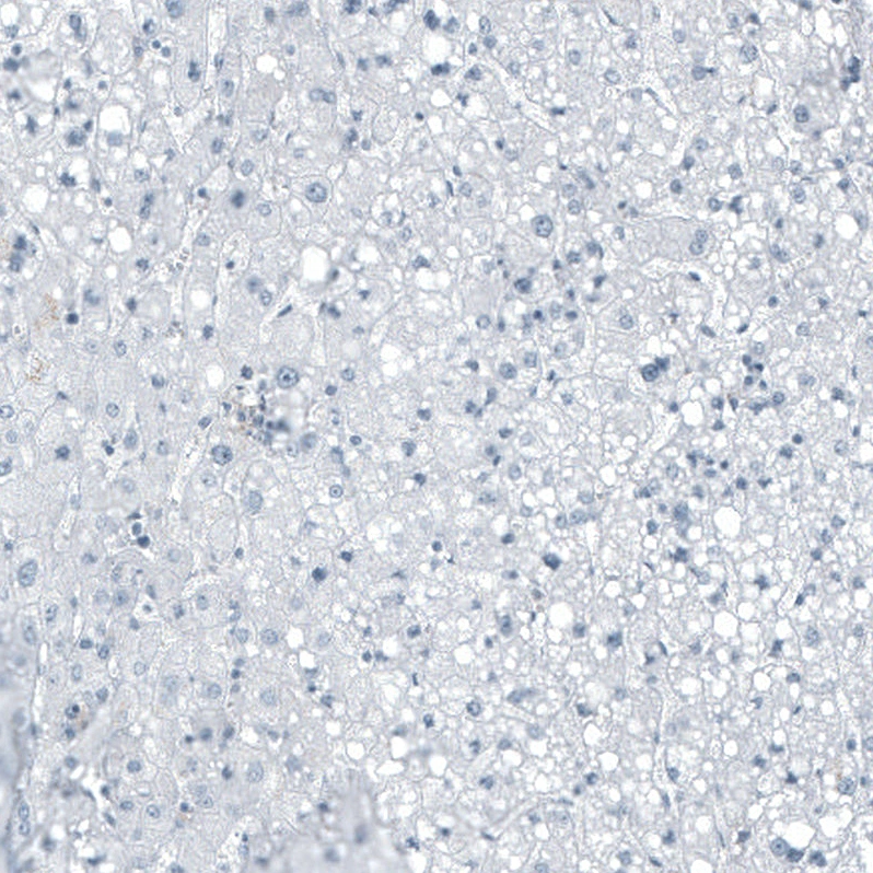 Anti-SLC22A2 Human Protein Atlas Antibody
