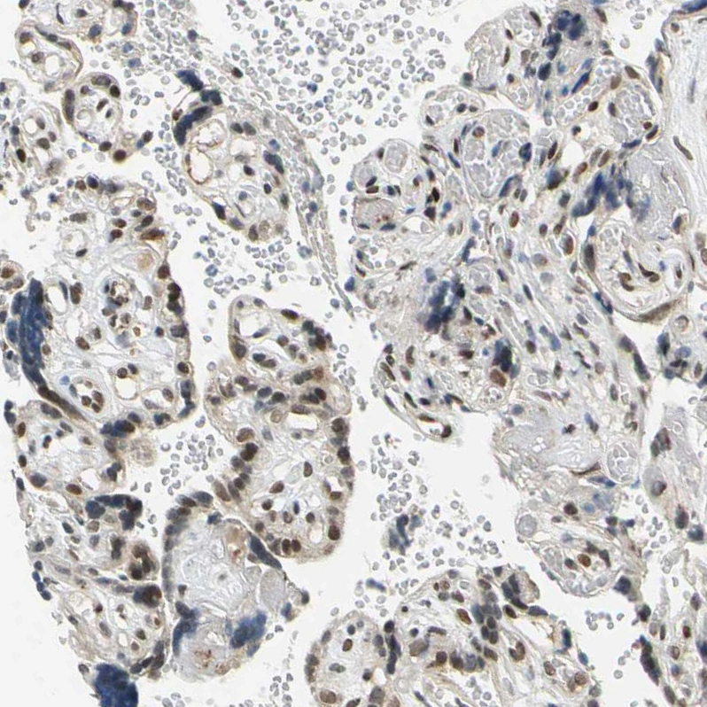 Anti-POGZ Human Protein Atlas Antibody