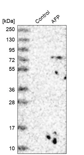Anti-AFP Human Protein Atlas Antibody