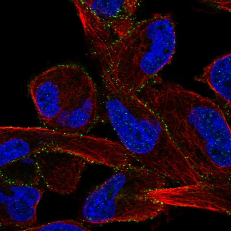 Rabbit Polyclonal Anti-ALK Antibody - Buy for research - Highly ...
