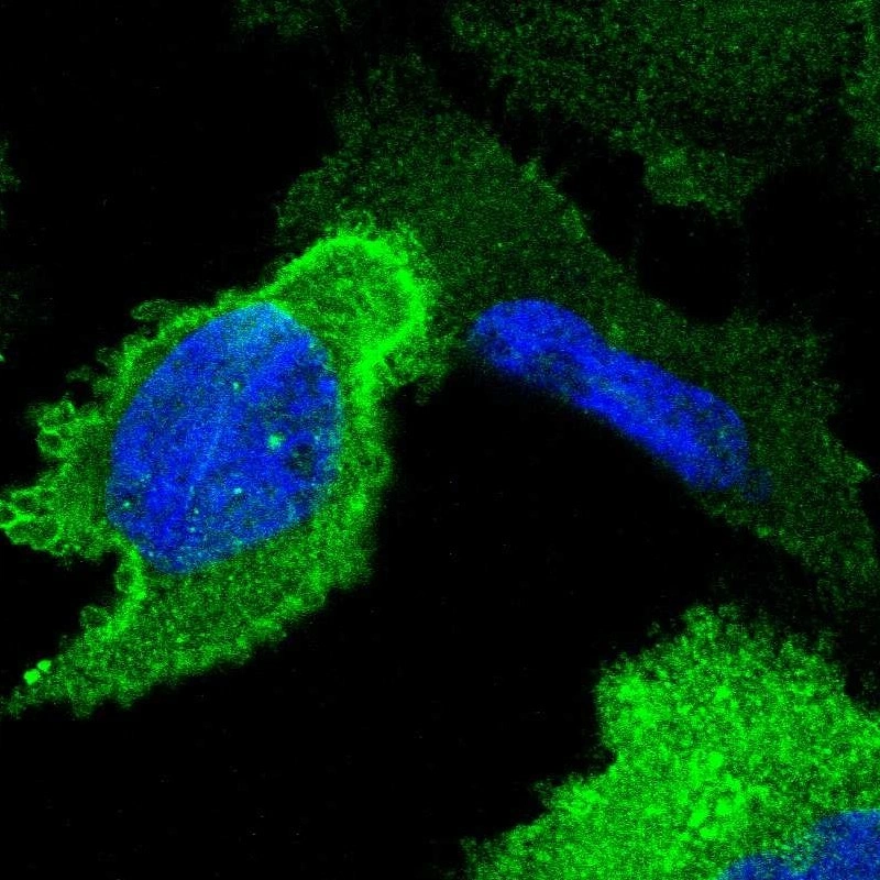 Anti-ANXA1 Human Protein Atlas Antibody