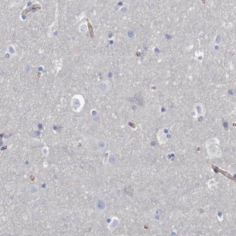 Rabbit Polyclonal Anti-NECTIN2 Antibody - Buy for research - Highly ...