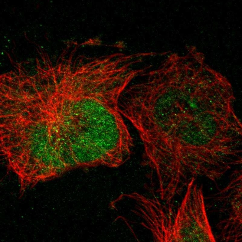 Anti-POMK Human Protein Atlas Antibody
