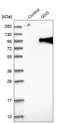 Rabbit Polyclonal Anti-GNS Antibody - Buy for research - Highly specific, rigorously validated ...