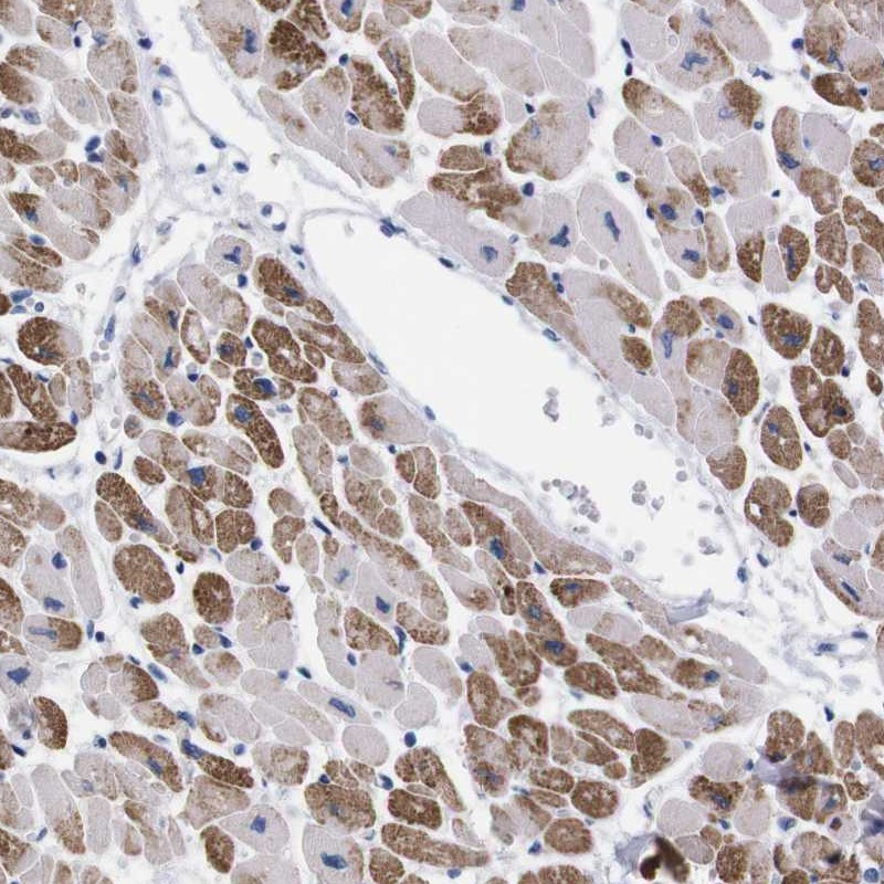 Rabbit Polyclonal Anti-NEBL Antibody - Buy for research - Highly specific, rigorously validated ...