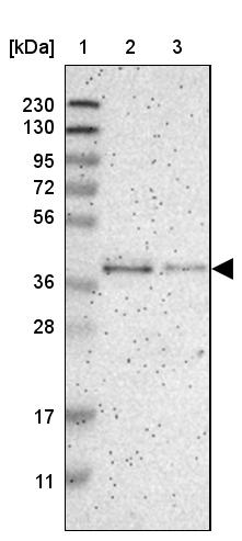 Rabbit Polyclonal Anti-GMPPB Antibody - Buy for research - Highly specific, rigorously validated ...